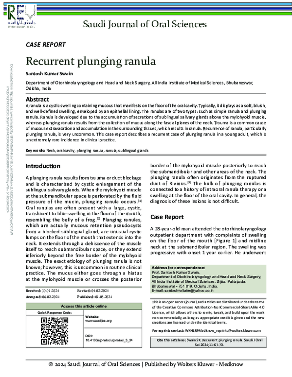 (PDF) Recurrent plunging ranula