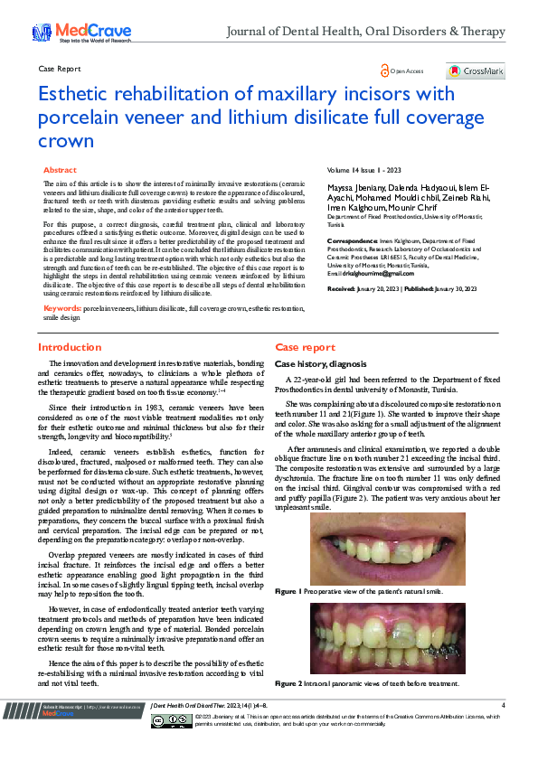 (PDF) Esthetic rehabilitation of maxillary incisors with porcelain ...