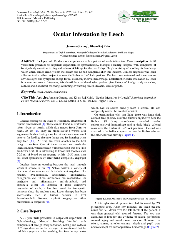 (PDF) Ocular Infestation by Leech