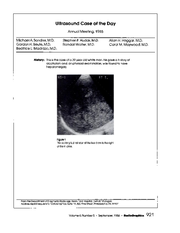 (PDF) Ultrasound case of the day. Focal fatty infiltration of the liver