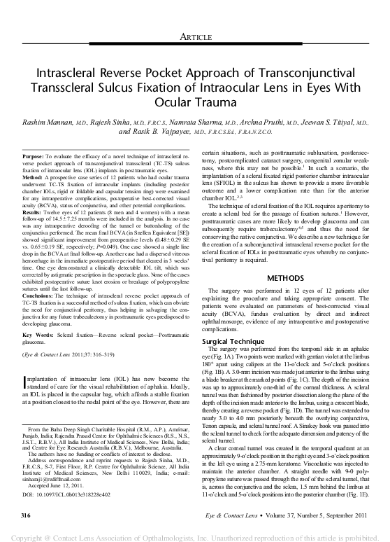 (PDF) Intrascleral Reverse Pocket Approach of Transconjunctival ...