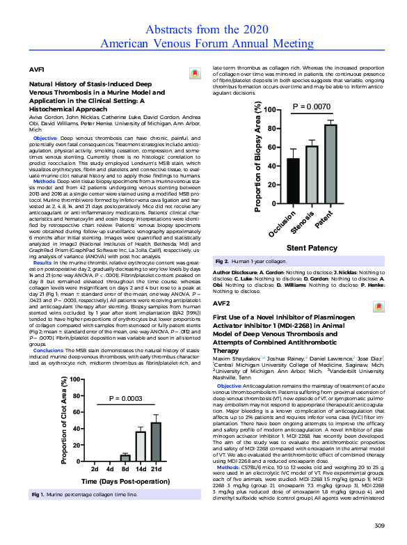 (PDF) Natural History of Stasis-Induced Deep Venous Thrombosis in a ...