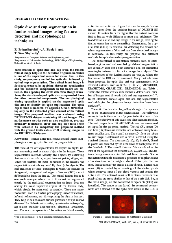(PDF) Optic Disc and Cup Segmentation in Fundus Retinal Images Using Feature Detection and ...