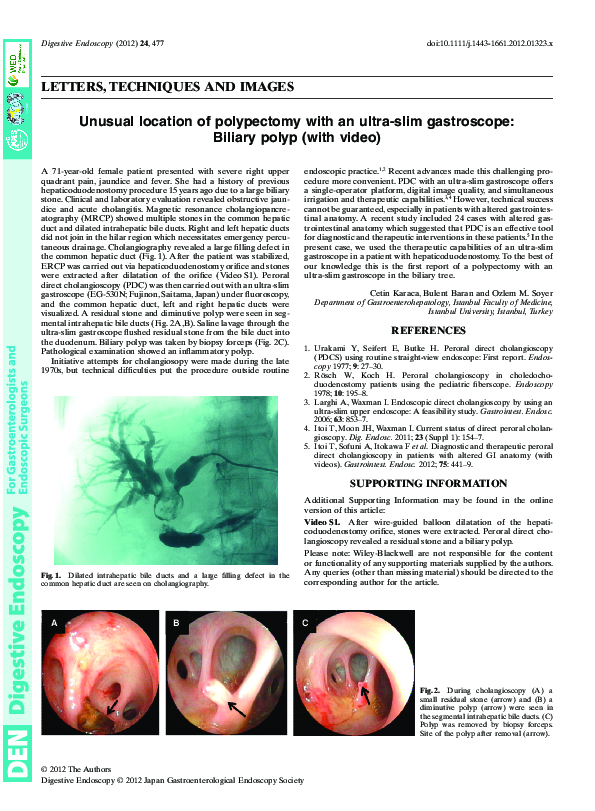 (PDF) Unusual location of polypectomy with an ultra-slim gastroscope ...