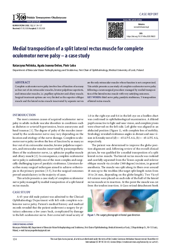 (PDF) Medial transposition of a split lateral rectus muscle for ...