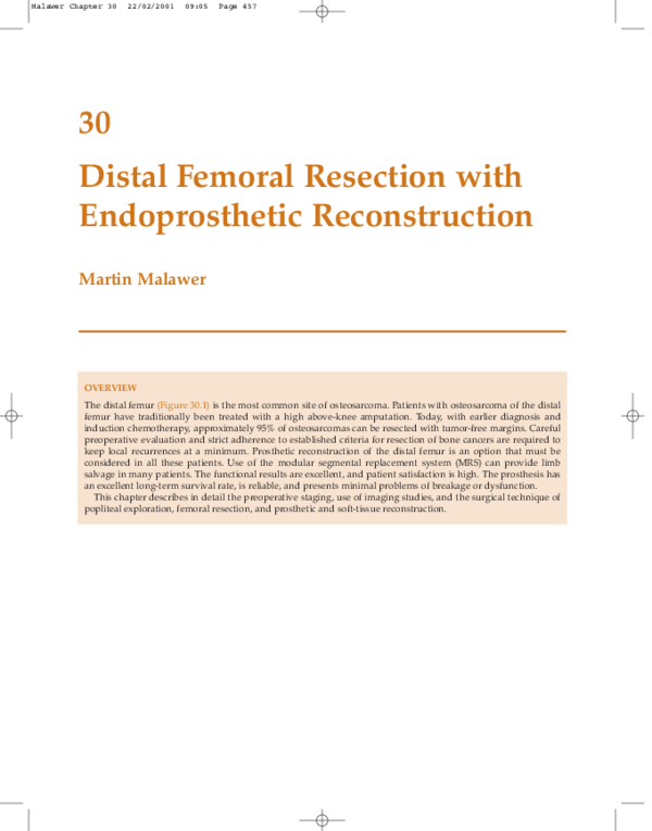 (PDF) Distal Femoral Resection with Endoprosthetic Reconstruction