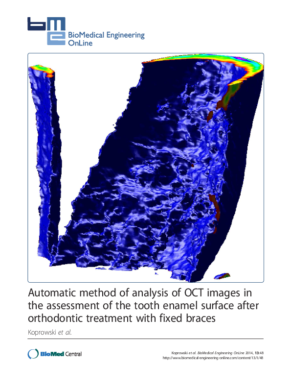 (PDF) Automatic method of analysis of OCT images in the assessment of ...