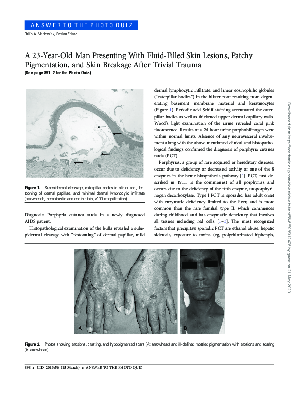 (PDF) A 23-Year-Old Man Presenting With Fluid-Filled Skin Lesions ...