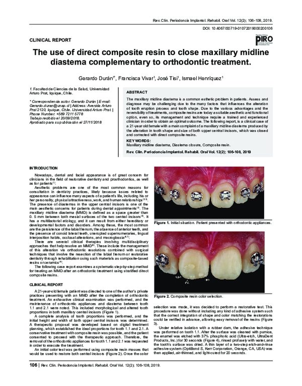 (PDF) The use of direct composite resin to close maxillary midline ...