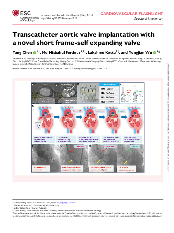 (PDF) Transcatheter aortic valve implantation with a novel short frame-self expanding valve ...