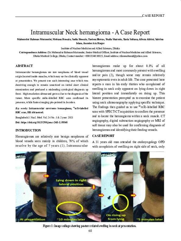 Pdf Case Report Intramuscular Neck Hemangioma