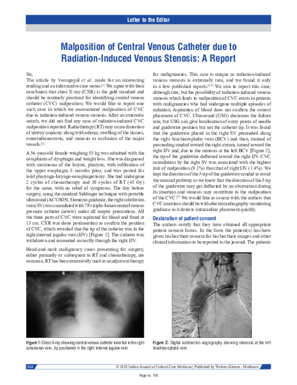 (PDF) Malposition of Central Venous Catheter due to Radiation-Induced ...