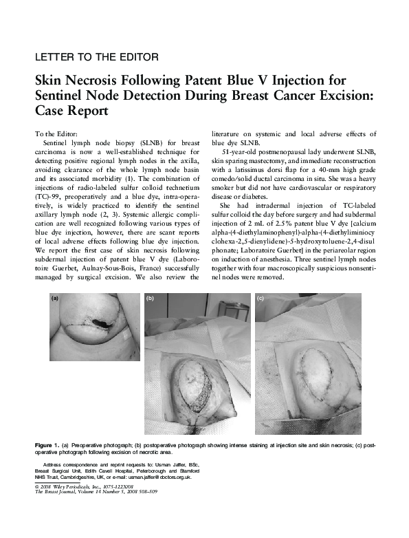 (PDF) Skin Necrosis Following Patent Blue V Injection for Sentinel Node ...