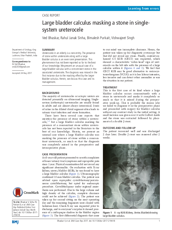 (PDF) Large bladder calculus masking a stone in single-system ureterocele