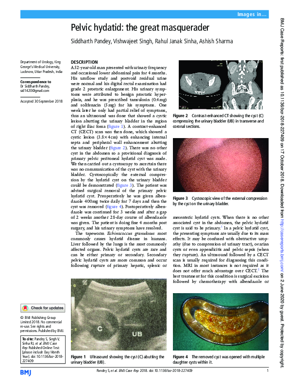 (PDF) Pelvic hydatid: the great masquerader