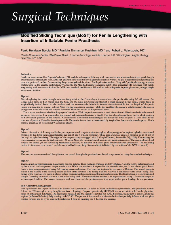 (PDF) Modified Sliding Technique (MoST) for Penile Lengthening with ...