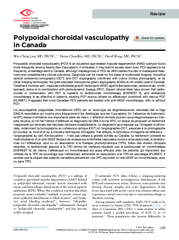 (PDF) Polypoidal choroidal vasculopathy in Canada