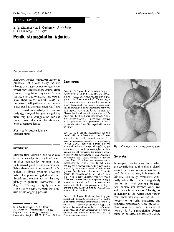 (PDF) Penile strangulation injuries | T.c. Ahmet Özdamar - Academia.edu