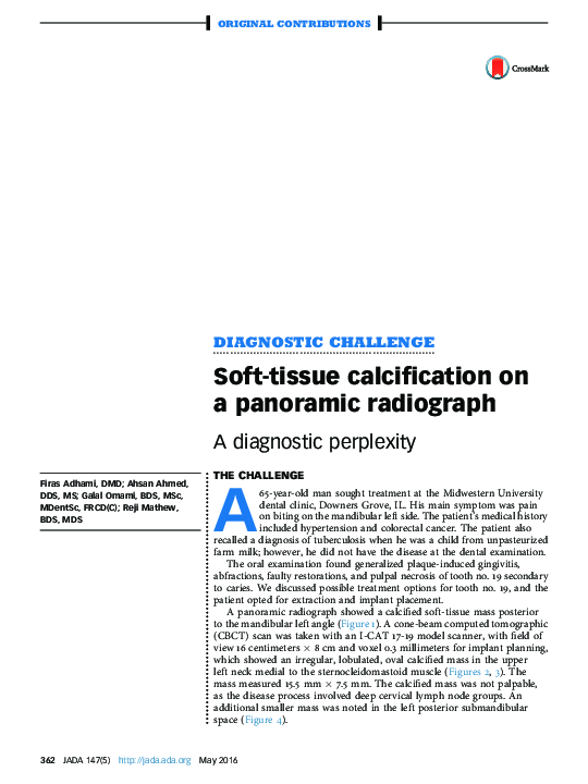 (PDF) Soft-tissue calcification on a panoramic radiograph