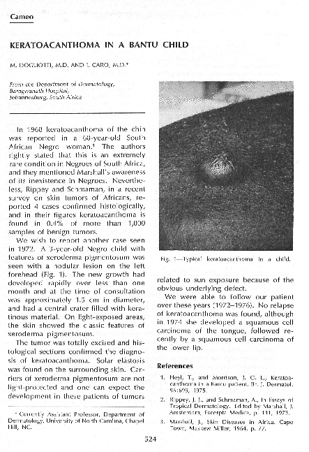 (PDF) Keratoacanthoma in a Bantu Child
