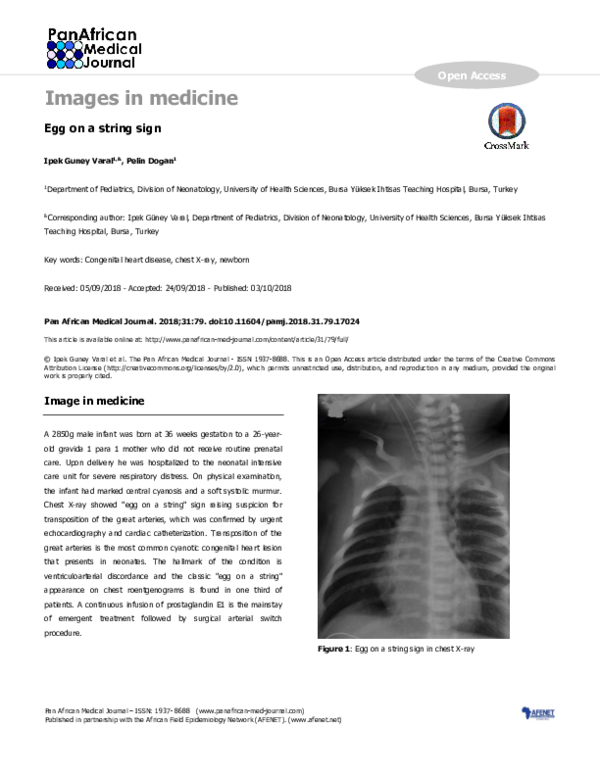 (PDF) Egg on a string sign