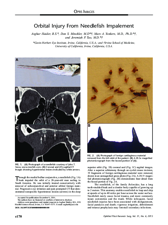 (PDF) Orbital Injury From Needlefish Impalement