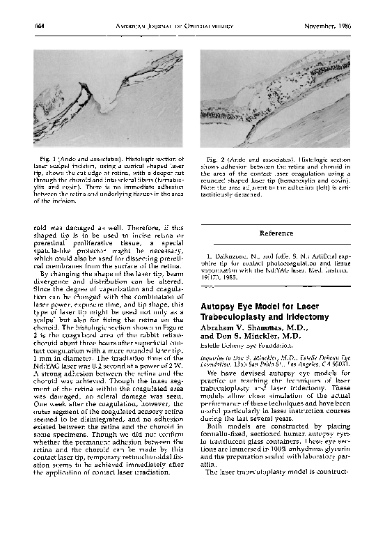(PDF) Autopsy Eye Model for Laser Trabeculoplasty and Iridectomy