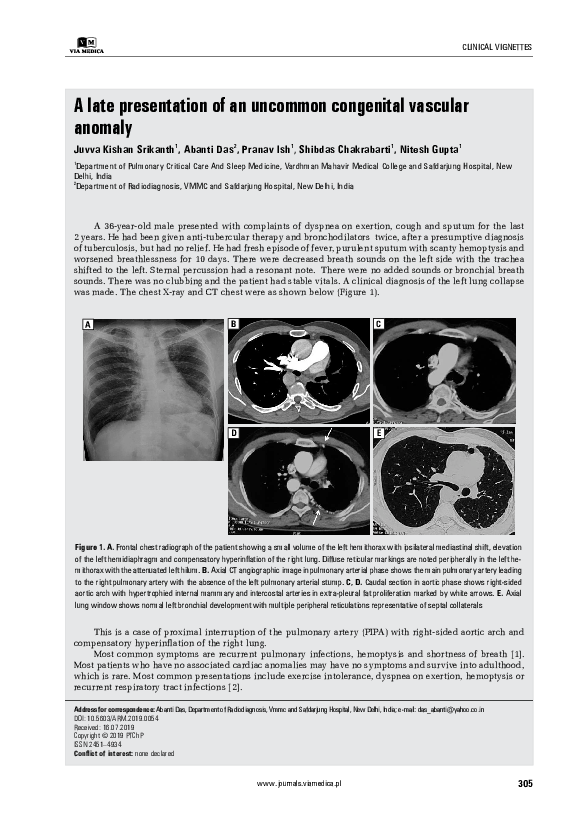 (PDF) A Late Presentation of an Uncommon Congenital Vascular Anomaly ...