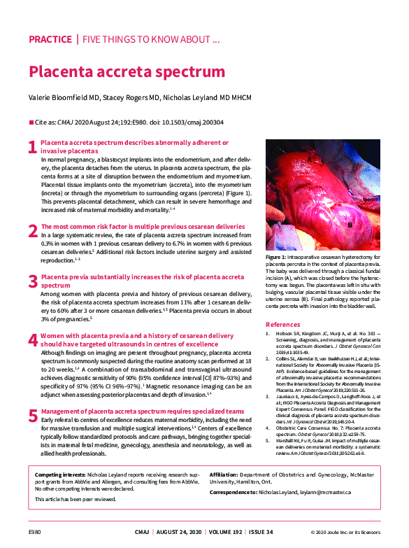 (PDF) Placenta accreta spectrum