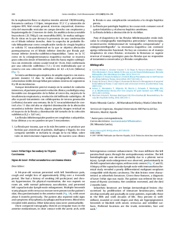 (PDF) Leser-Trélat Sign Secondary to Thymic Carcinoma