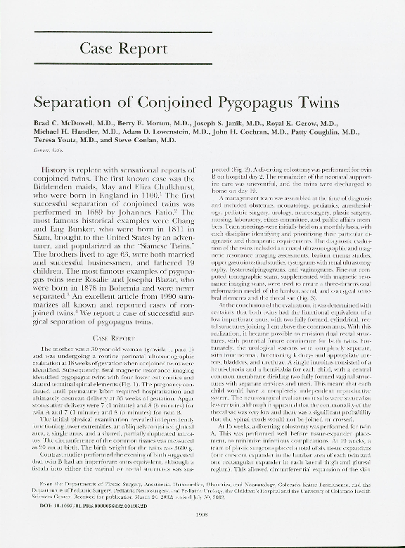 (PDF) Separation of Conjoined Pygopagus Twins