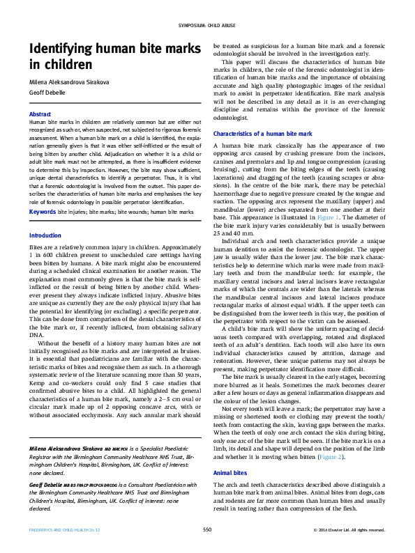 (PDF) Identifying human bite marks in children