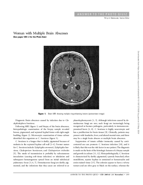(PDF) Woman with Multiple Brain Abscesses