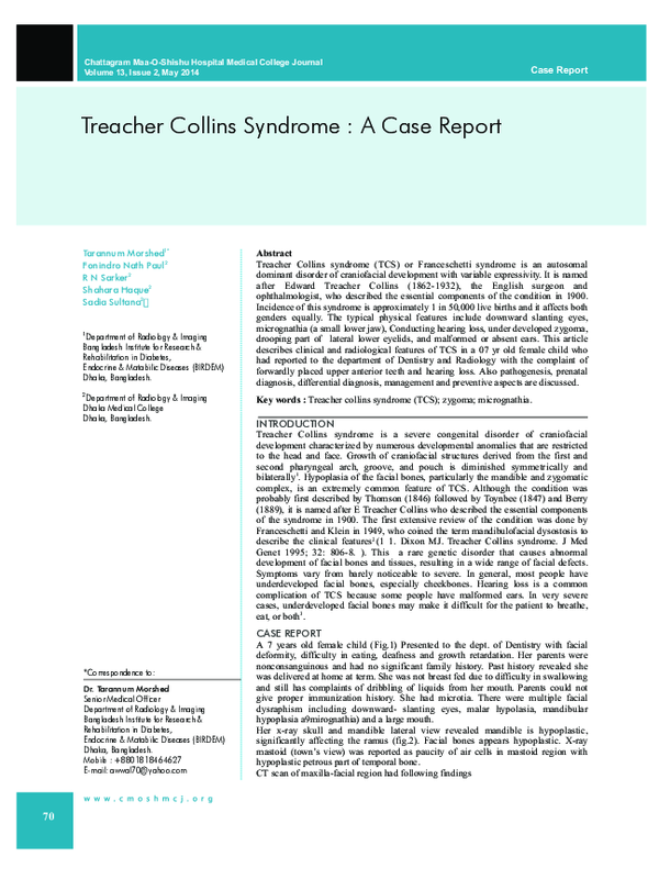 (PDF) Treacher Collins Syndrome : A Case Report
