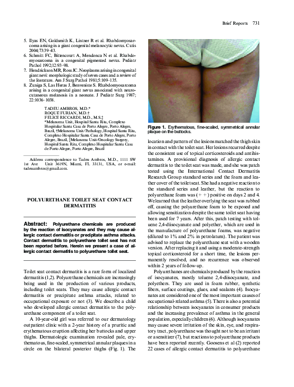 (PDF) Polyurethane Toilet Seat Contact Dermatitis