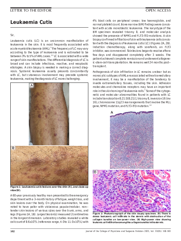(PDF) Leukaemia Cutis | Farjah Algahtani - Academia.edu