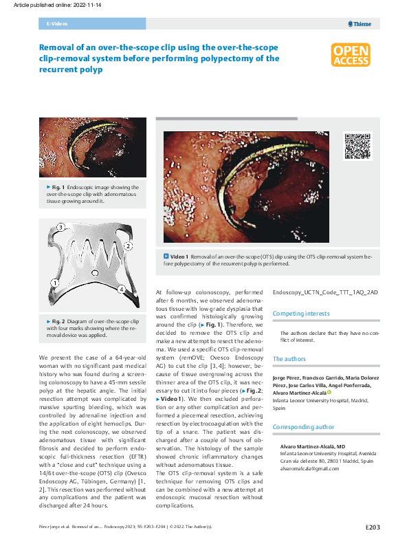 (PDF) Removal of an over-the-scope clip using the over-the-scope clip ...