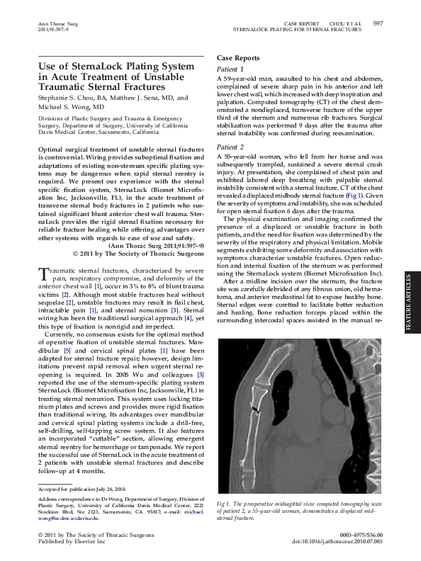 (PDF) Use of SternaLock Plating System in Acute Treatment of Unstable ...