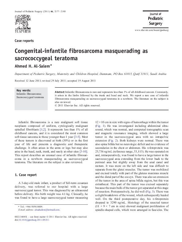 (PDF) Congenital-infantile fibrosarcoma masquerading as sacrococcygeal ...
