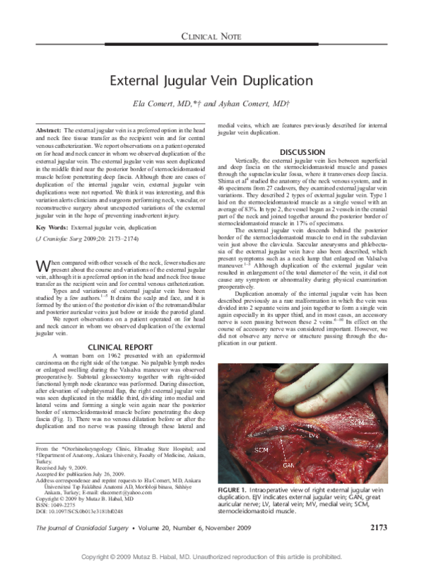 (PDF) External Jugular Vein Duplication