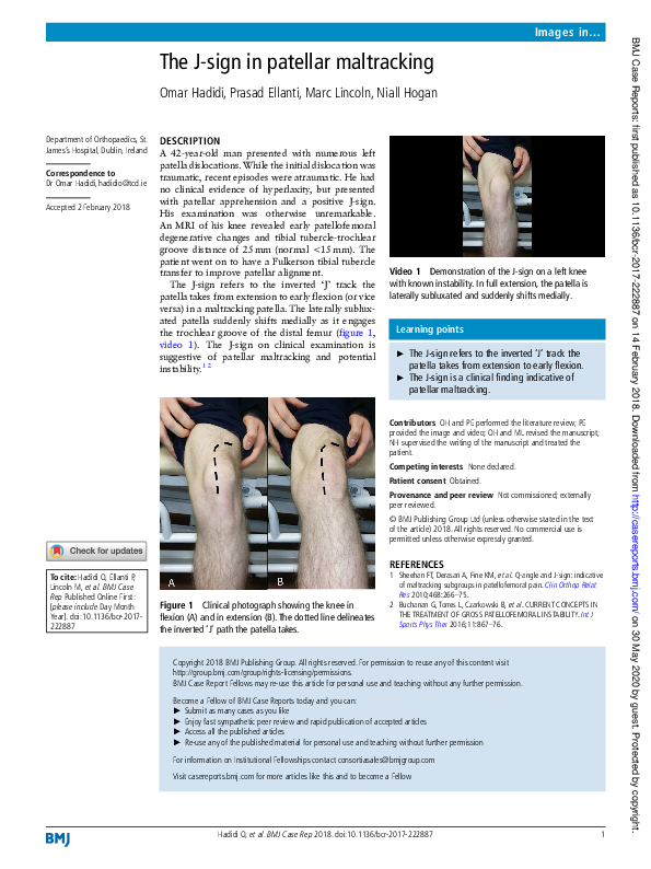 (PDF) The J-sign in patellar maltracking