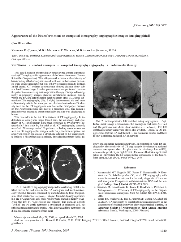(PDF) Appearance of the Neuroform stent on computed tomography ...