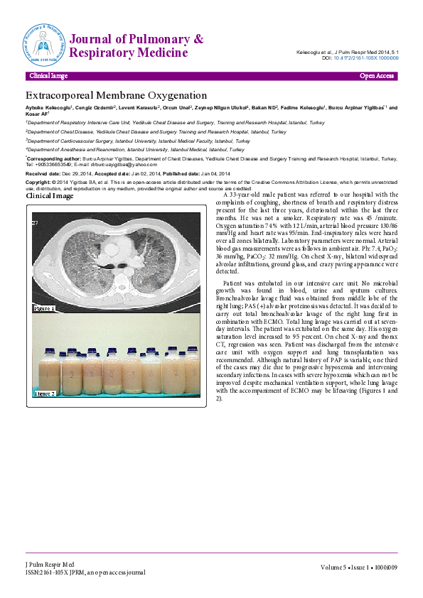 (PDF) Extracorporeal Membrane Oxygenation