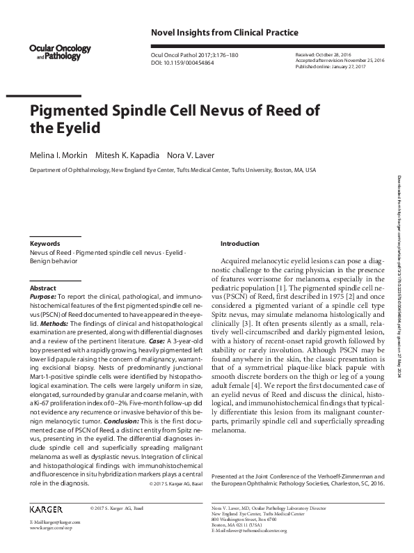 (PDF) Pigmented Spindle Cell Nevus of Reed of the Eyelid
