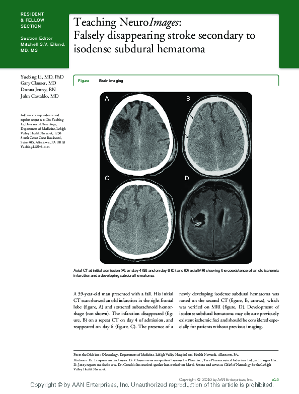 (PDF) Teaching NeuroImages: Falsely disappearing stroke secondary to ...