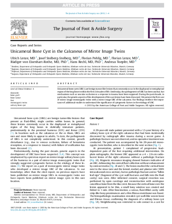 (PDF) Unicameral Bone Cyst in the Calcaneus of Mirror Image Twins