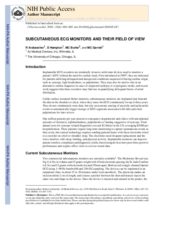 (PDF) Subcutaneous electrocardiogram monitors and their field of view