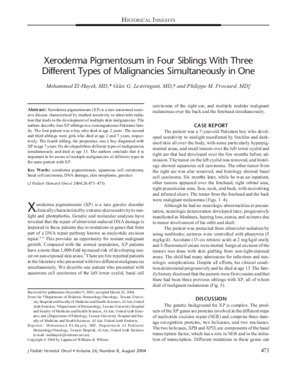 (PDF) Xeroderma Pigmentosum in Four Siblings With Three Different Types ...