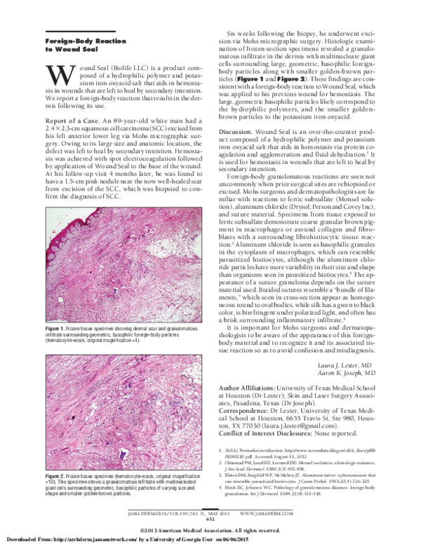 (PDF) Foreign-Body Reaction to Wound Seal