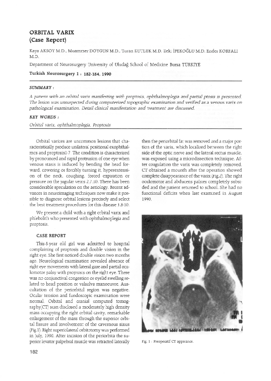 (PDF) ORBITAL VARIX (Case Report)